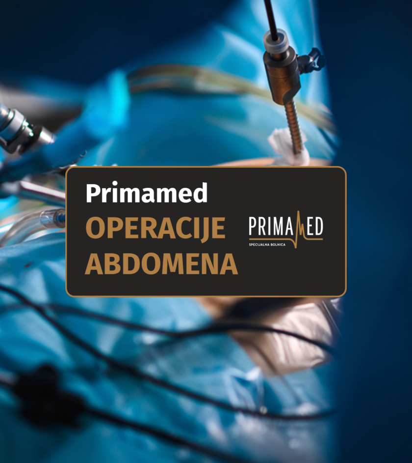 Operacije abdomena | Primamed Specijalna Bolnica